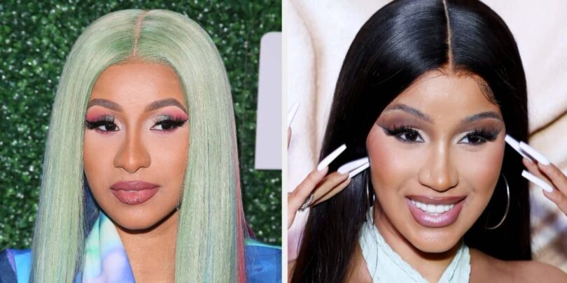 Cardi B Plastic Surgery: The Rapper's Bold Beauty Choices - citiMuzik